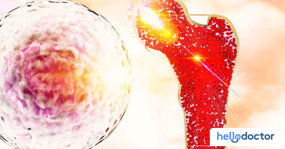 The Early Signs of Bone Cancer: What You Should Know - Hello Doctor