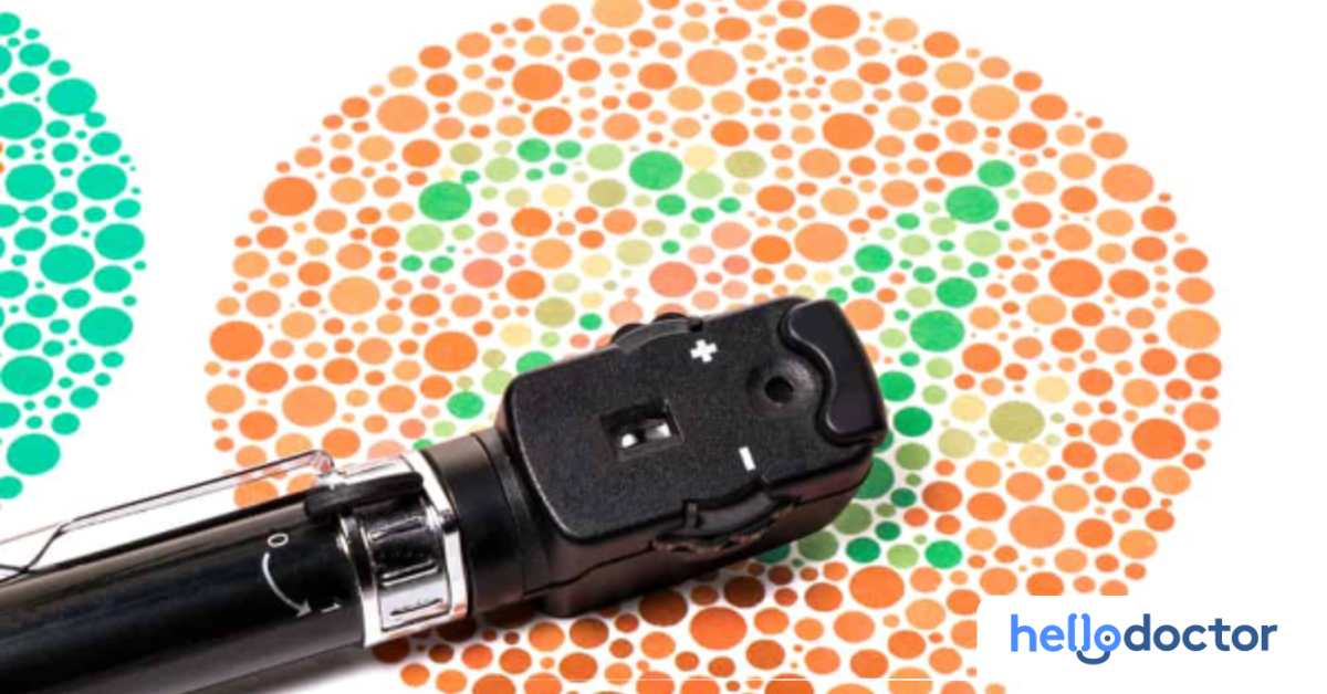 Color Blindness Diagnosis and Treatment : What to Know