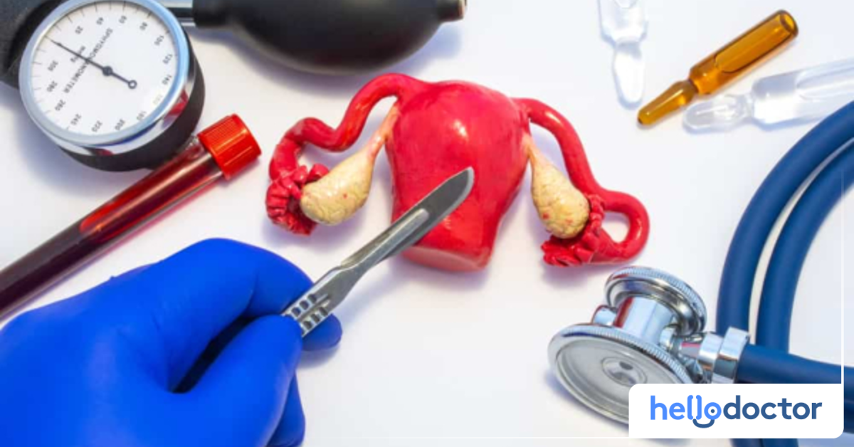 Myoma Treatment Without Surgery - Is It Possible?