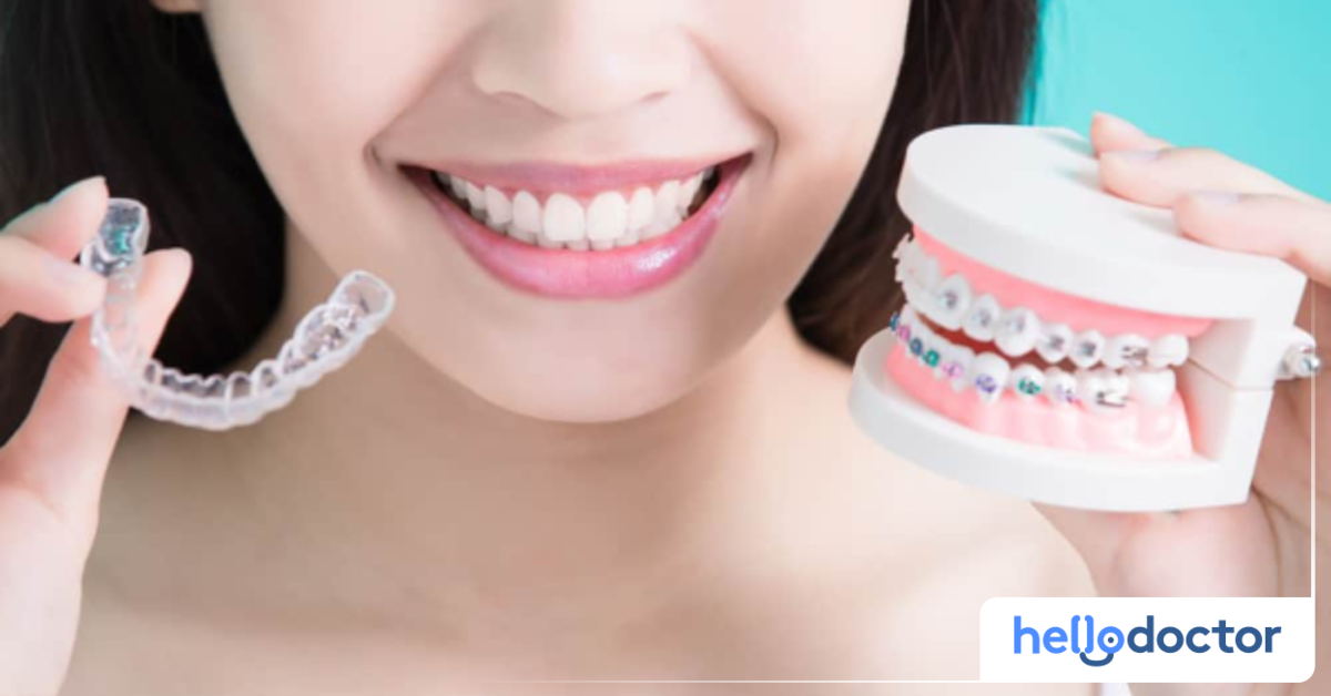 Orthodontic Braces: What To Expect Before, During, and After