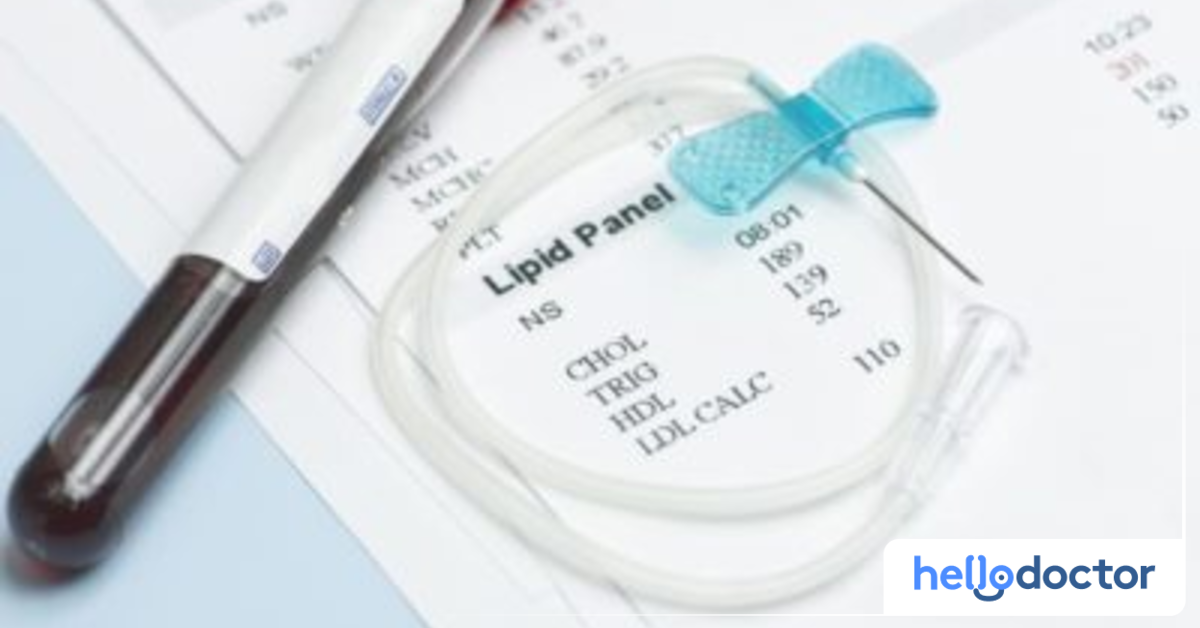 LDL Test (Low-Density Lipoprotein): Why And How Is It Done?