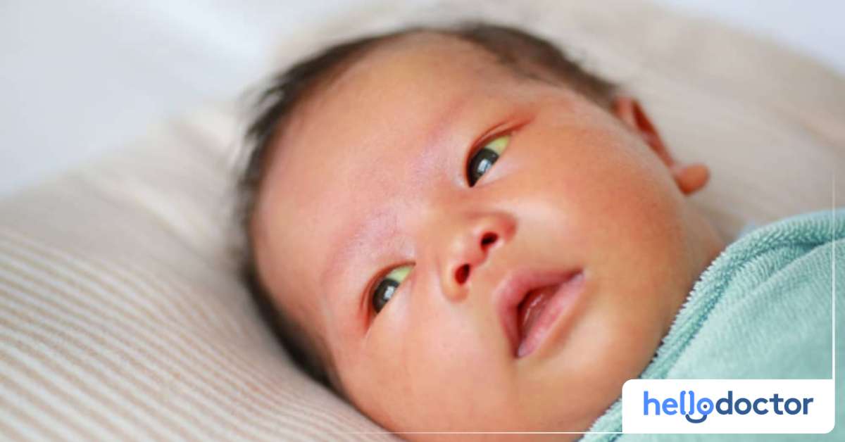 Yellow Baby: What Causes Infant Jaundice and How It's Treated