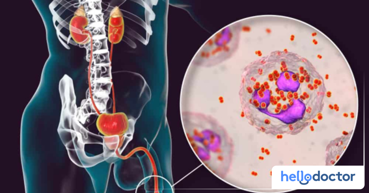 I Have Gonorrhea Symptoms: What Should I Do Next?