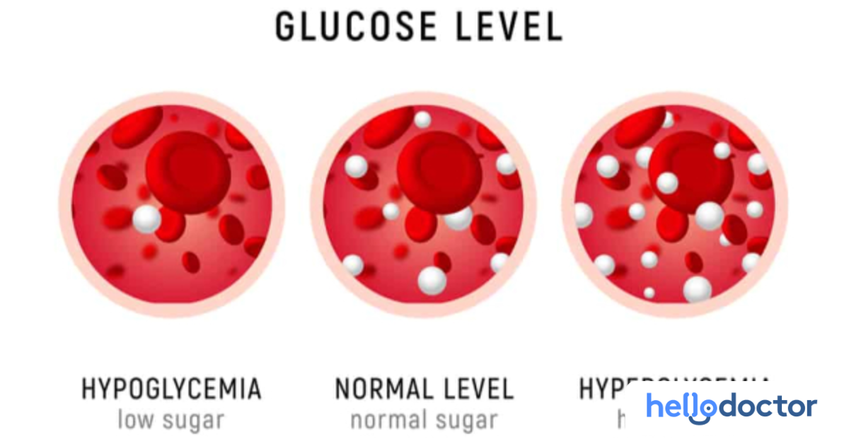 What is Hyperglycemia? Here Are the Symptoms and Treatments
