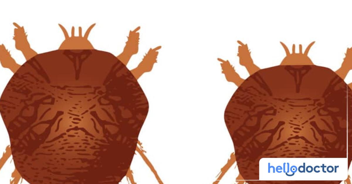 How to Identify Scabies: Watch Out For Itchy Skin and Burrows