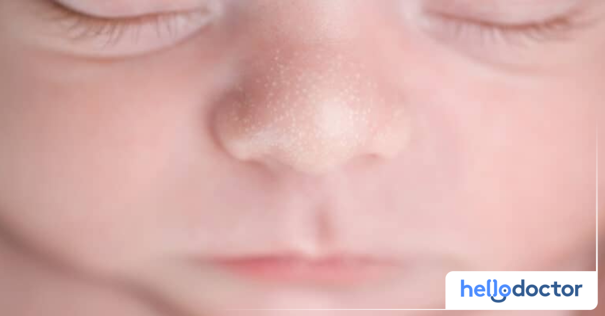 Medicine For Baby Rash On Body? Dealing With Baby Rashes