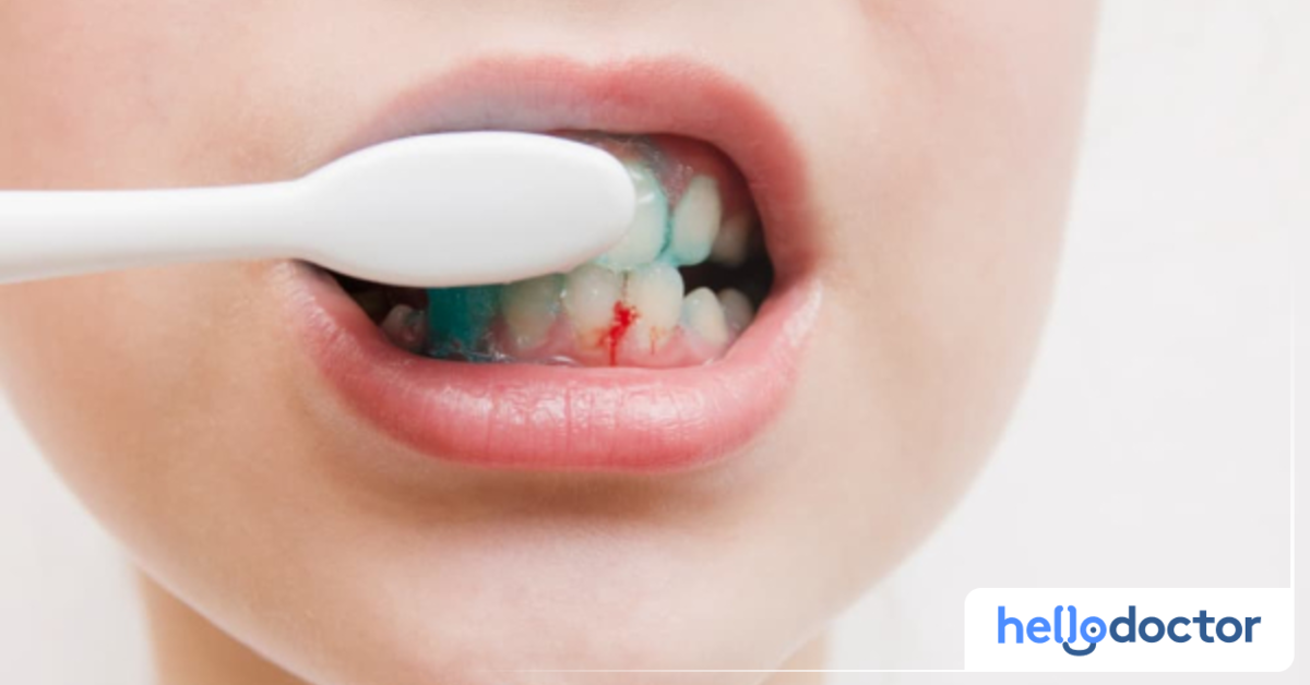 All About Scurvy Disease: What It Is and How To Deal With It