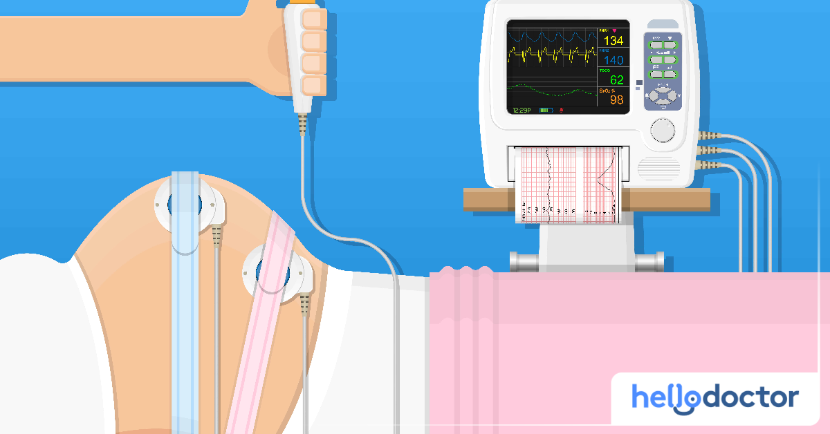 Nonstress Test (NST) During Pregnancy: Why and How is it Done?