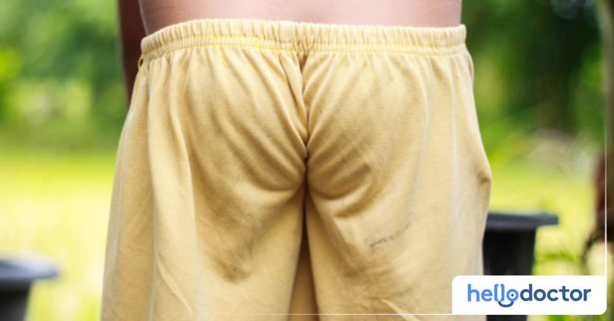 Chafing Buttocks: Here’s Why You Need to Take Chafing Seriously