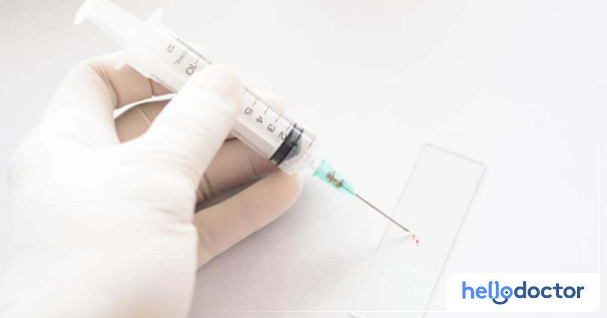 FNAC Test (Fine Needle Aspiration Cytology): Why and How is it Done?