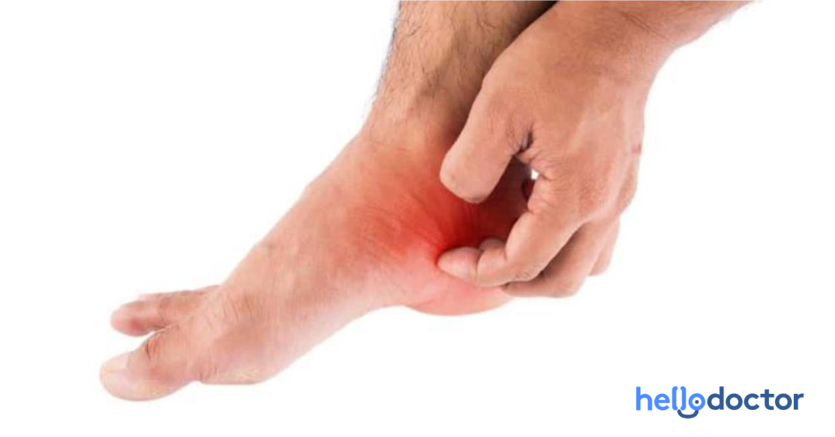 Kulugo: Paano Ito Nagagamot, at Paano Makakaiwas Dito?