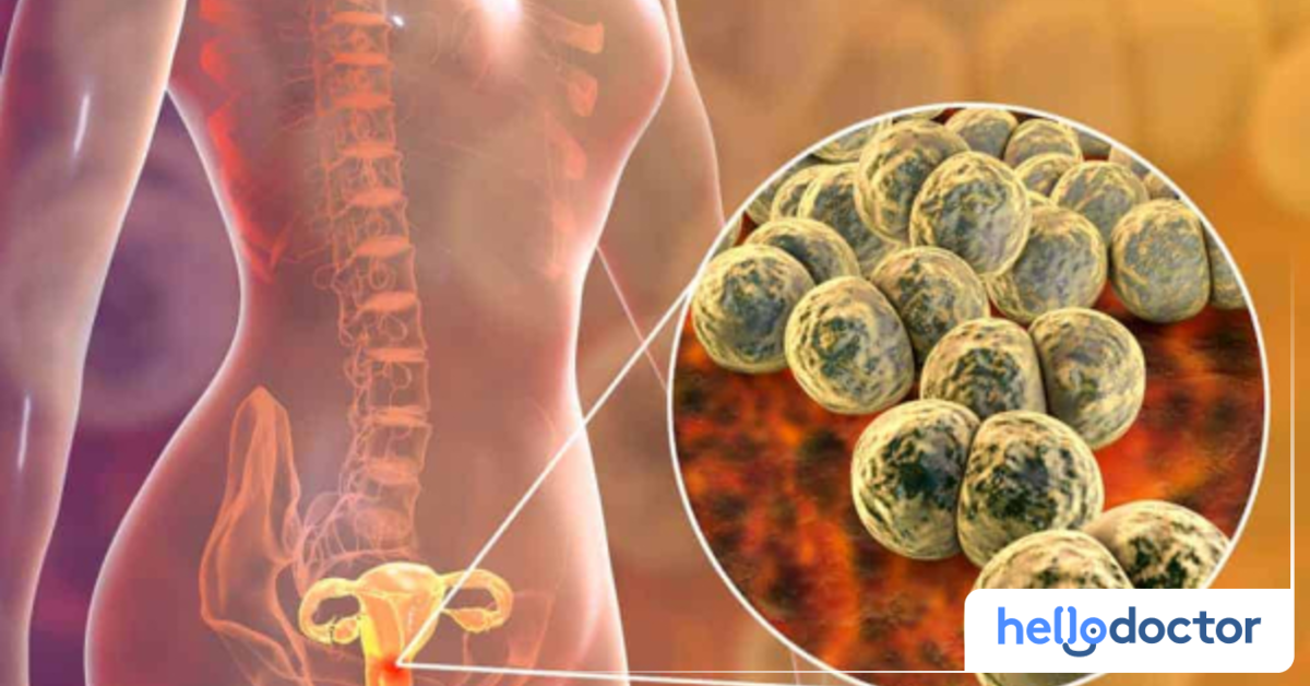 Gamot Sa Gonorrhea: Heto Ang Tamang Gamot Sa Sakit Na Ito
