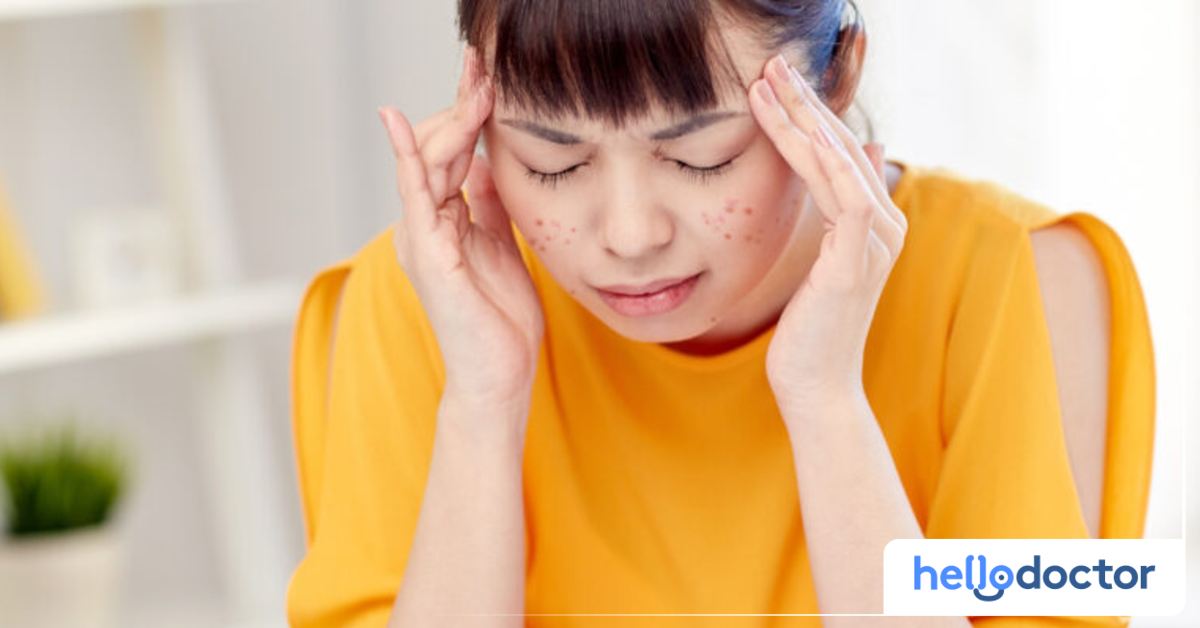 Does Stress Cause Pimples How Stress Affects Acne