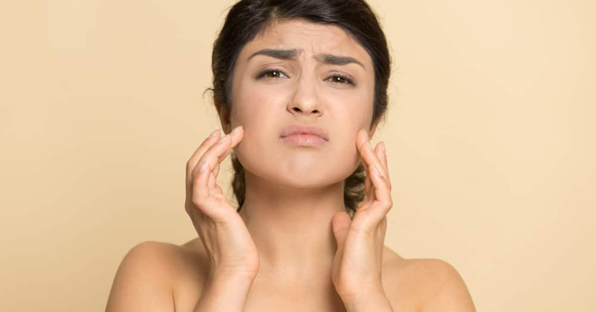 Pimples on Face? Do’s and Don’ts of Acne Treatment