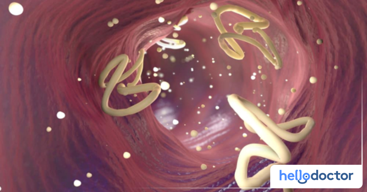 PInworm: How To Diagnose, Treat, And Prevent This Condition