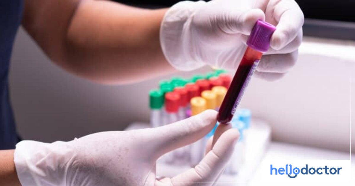 HbA1c Meaning: The Gold Standard To Monitor Glycemic Control