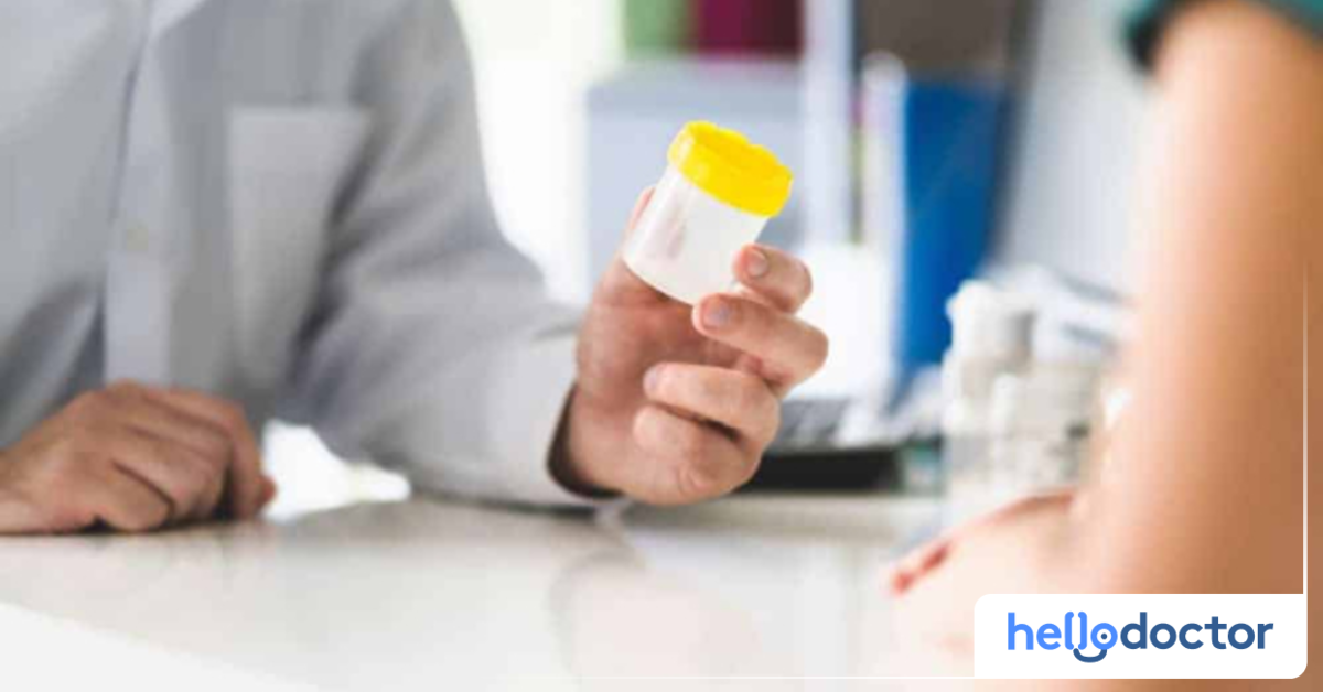 Colon Cancer Test: Understanding The FIT Kit And Its Effectivity