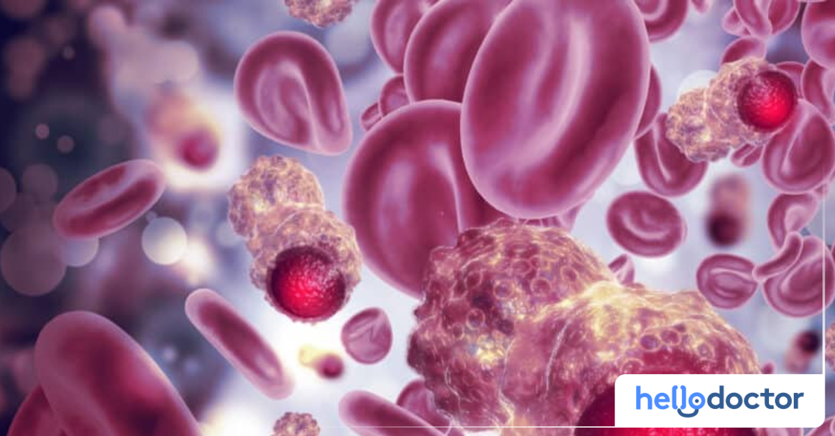 Rare Cancer: The Different Types And Survival Rates