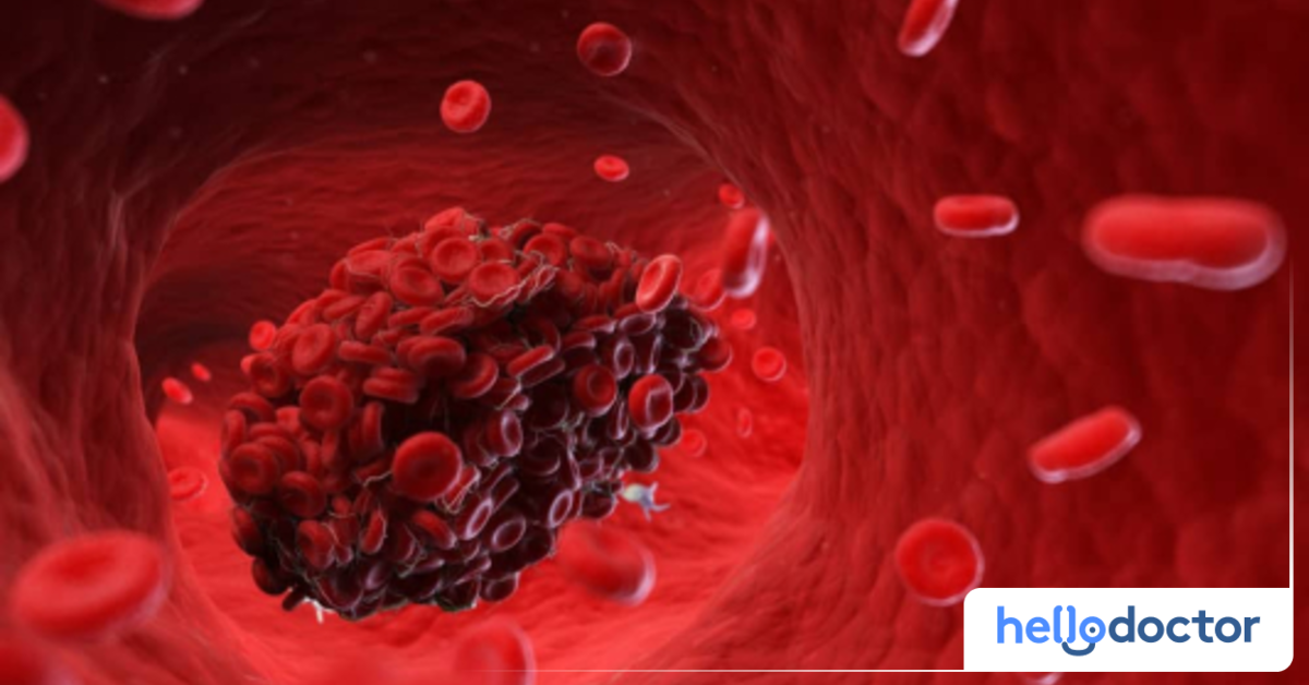 Picture Of Blood: A Closer Look Into Blood Composition And Conditions