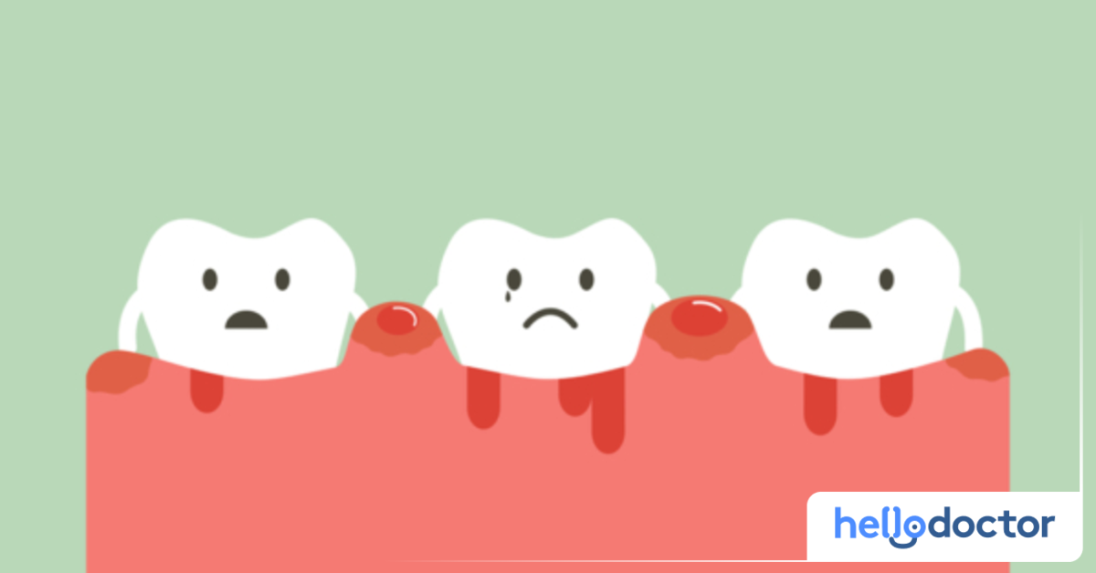 What Are Swollen Gums A Sign Of? Learn More Here