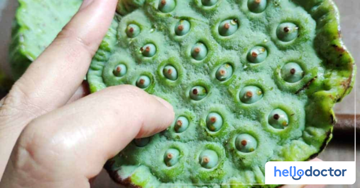 Trypophobia: What You Need to Know And Can You Overcome It?